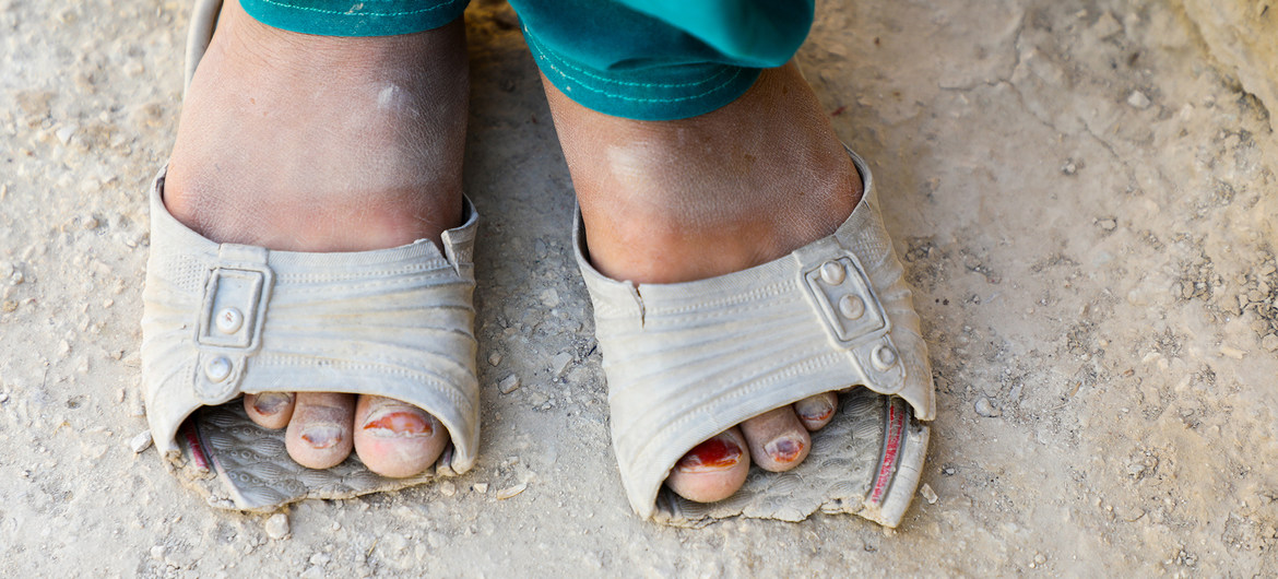 Stand in solidarity with world’s poor, UN chief says in message for ...